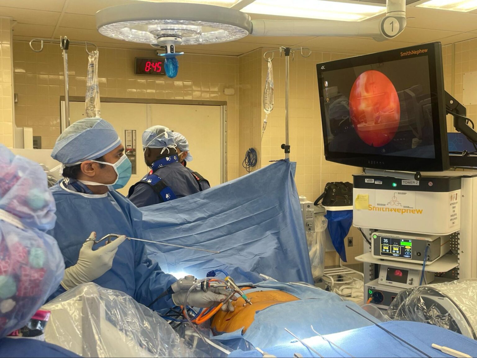 Endoscopic Discectomy vs. Microdiscectomy - UOA - University ...